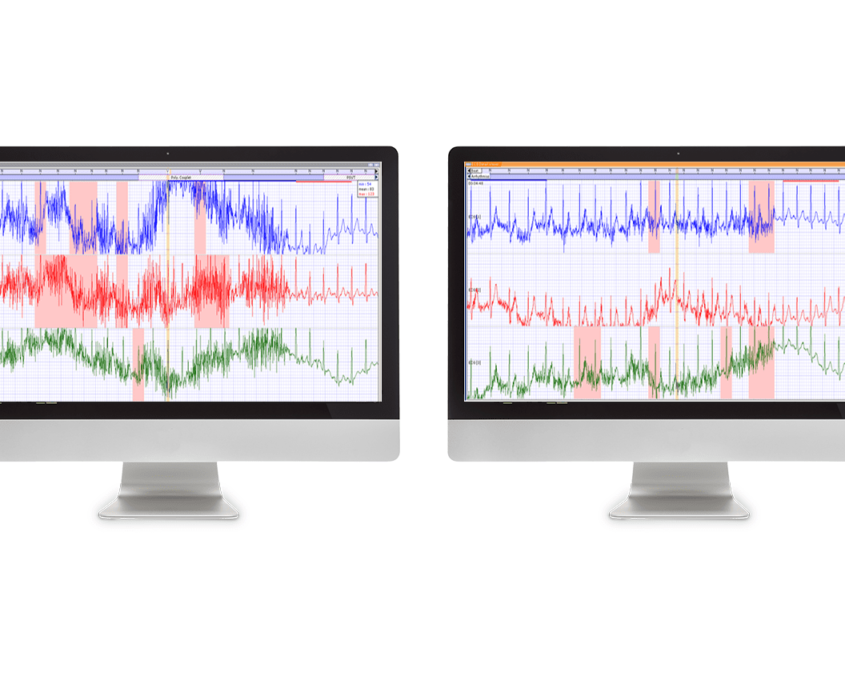 ITX MEDICAL EQUIPMENT AND LAB SUPPLIES